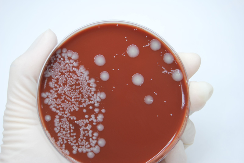 Super Bacteria? – BTW – Stuff You Should Know
